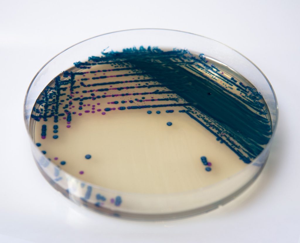 Tubo Meio Rugai Modificado – 13x100mm – Plastlabor