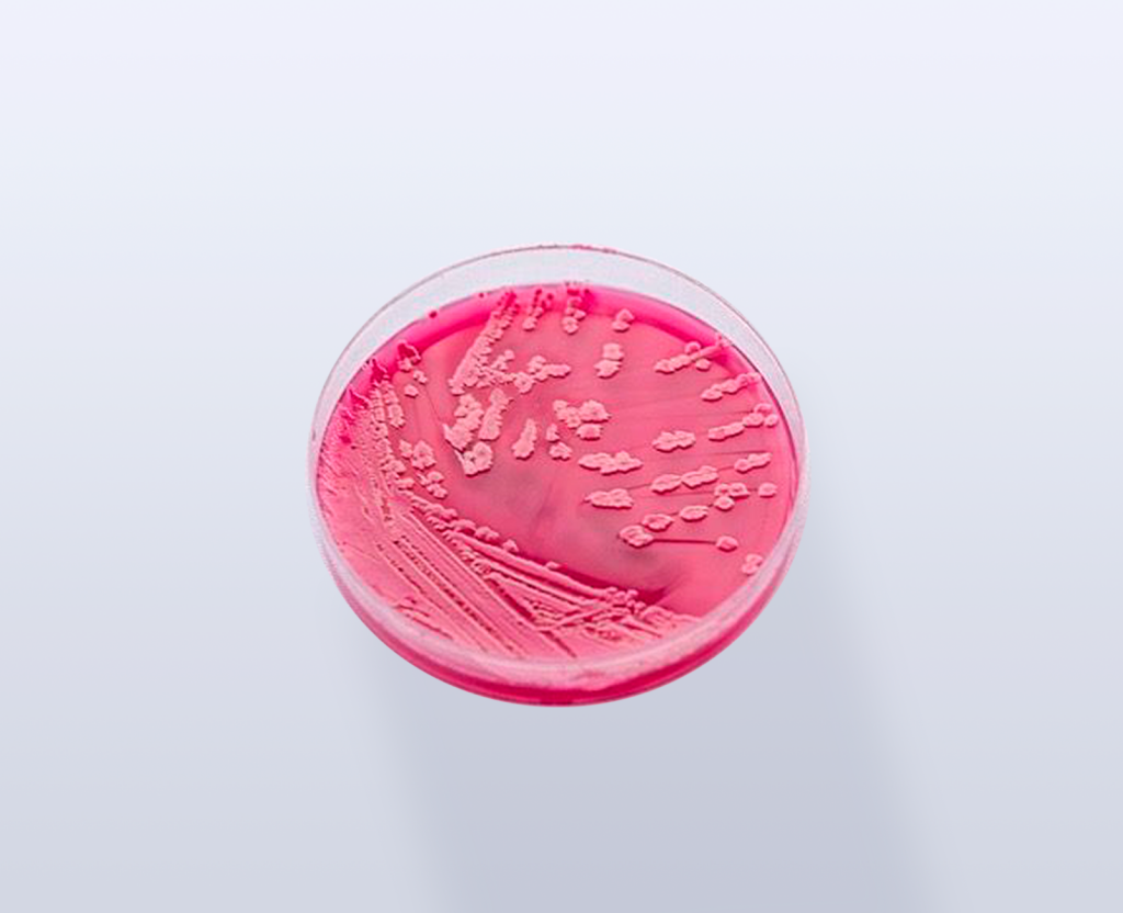 Placa Ágar Macconkey – 90mm – Plastlabor
