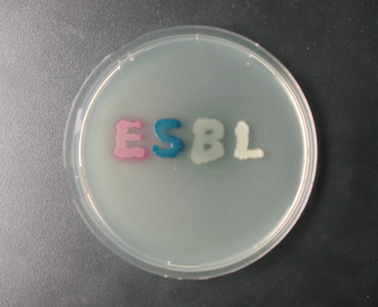 Placa CHROMagar ESBL – 90 mm – Plastlabor