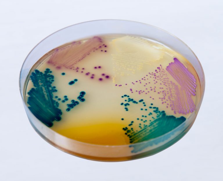 Placa CHROMagar Orientation – 90 mm – Plastlabor