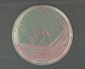 Placa CHROMagar MRSA – 90 mm – Plastlabor