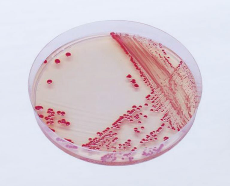 Placa CHROMagar StrepB – 90mm – Plastlabor