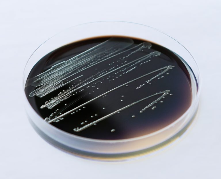 Tubo Meio Lowenstein Jensen – 16x150mm – Plastlabor