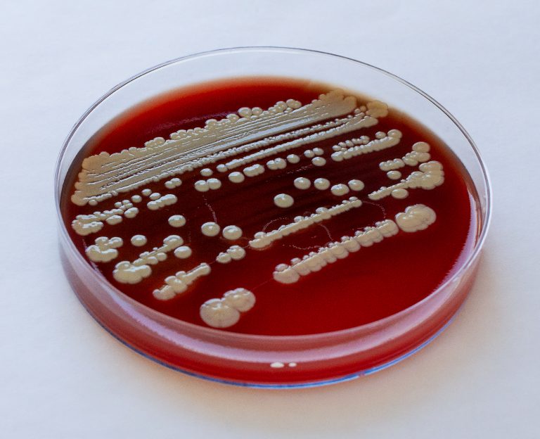 Placa CHROMagar MRSA – 90 mm – Plastlabor