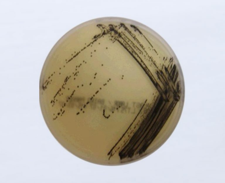 Placa Rodac TSA com Inativante com Penase Irradiada – Plastlabor