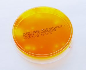 Placa Rodac TSA com Inativante com Penase Irradiada – Plastlabor