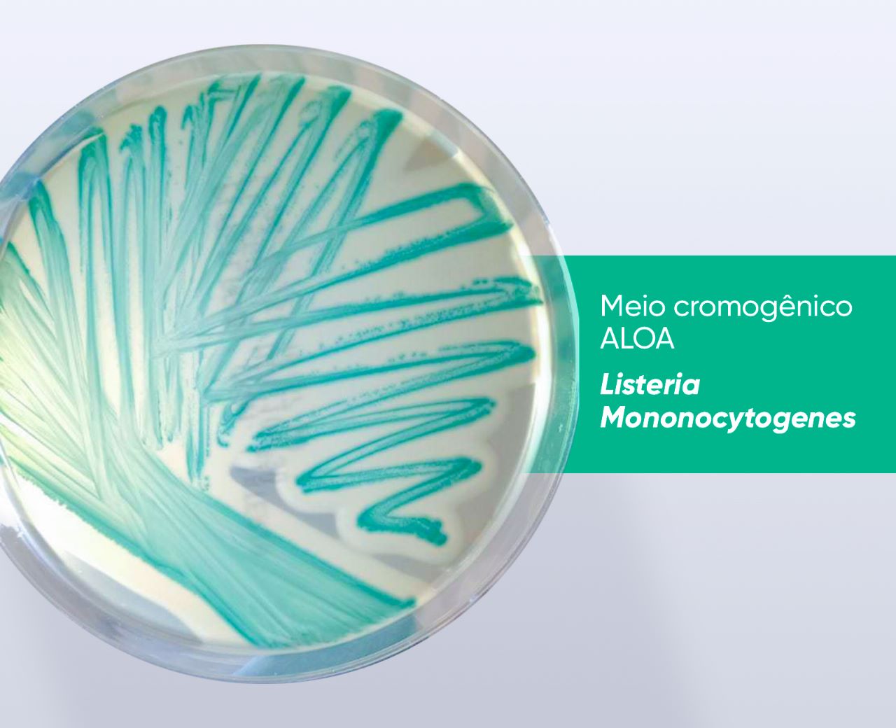 Importância da Listeria na indústria de alimentos – Plastlabor