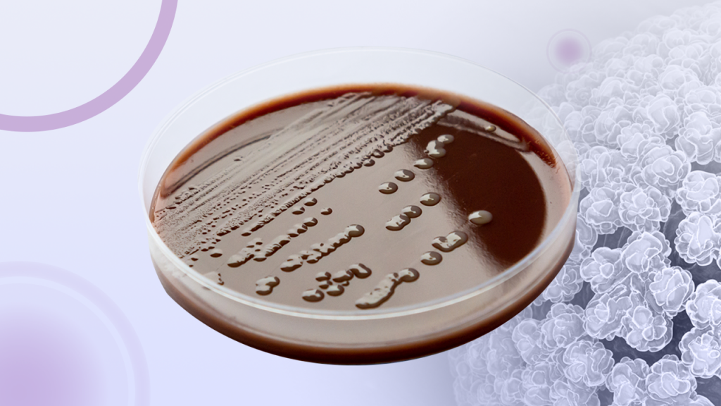 Gonorreia: cultura, isolamento e identificação – Plastlabor