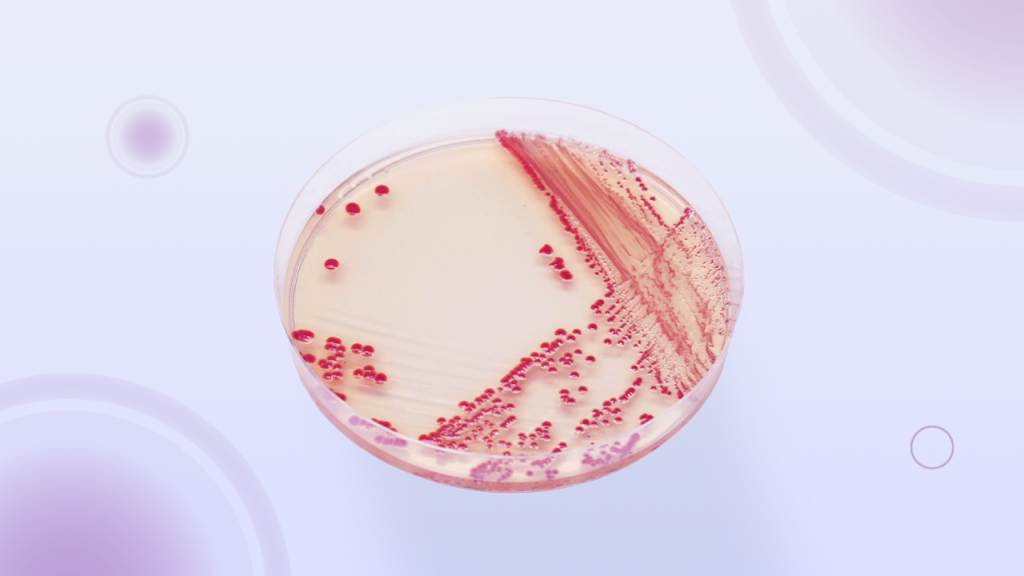 Meios cromogênicos – Plastlabor