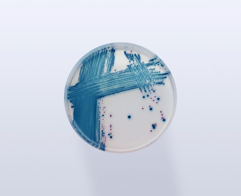 CHROMagar™ STEC – Plastlabor