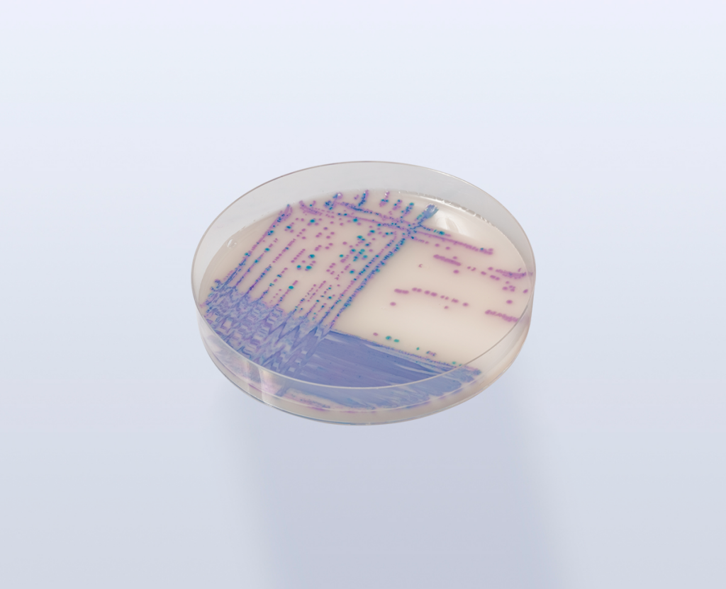 CHROMagar™ Salmonella Plus – Plastlabor